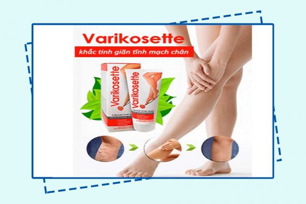 [Đánh giá] Kem Varikosette có tốt không? Hướng dẫn sử dụng, Review